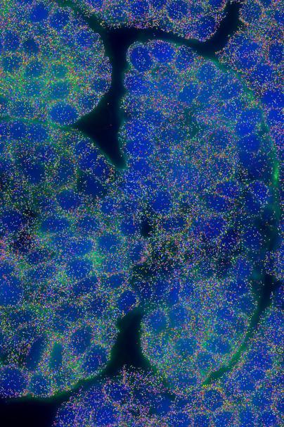 How To Use Spatial Transcriptomics To View Single Plant Cells In Situ